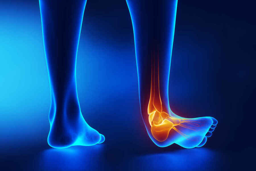 Broken Ankle Compensation - Your Rights & How To Claim