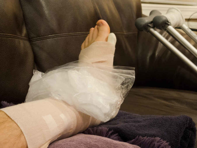 Crushed Foot Injury Compensation - Key Points On Claiming